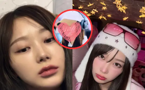 Female singer revealed serious injury on her face, was "ignored" by the ...