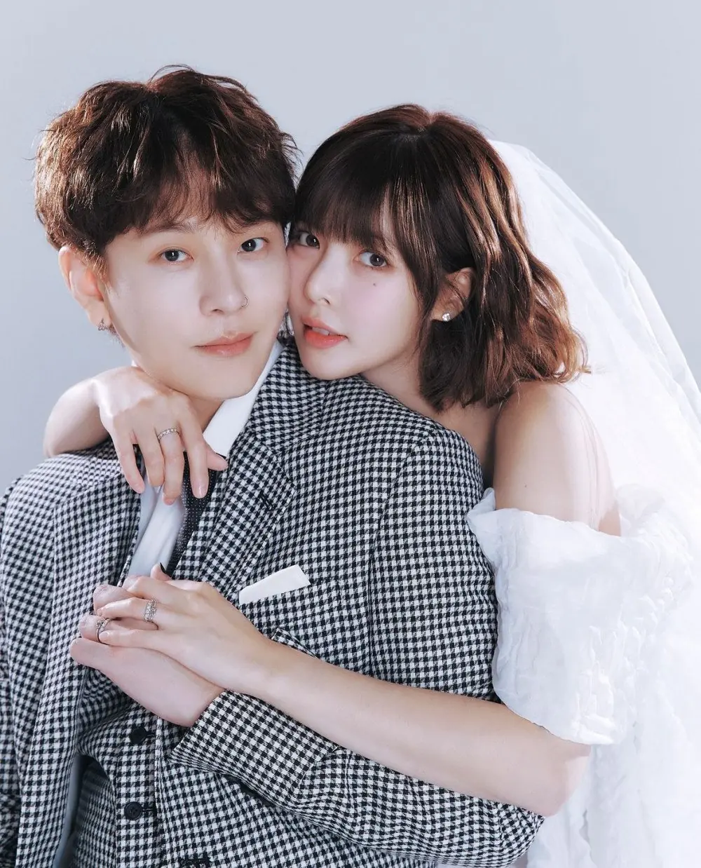HyunA & Yong Junhyung to tie the knot with a wedding ceremony today