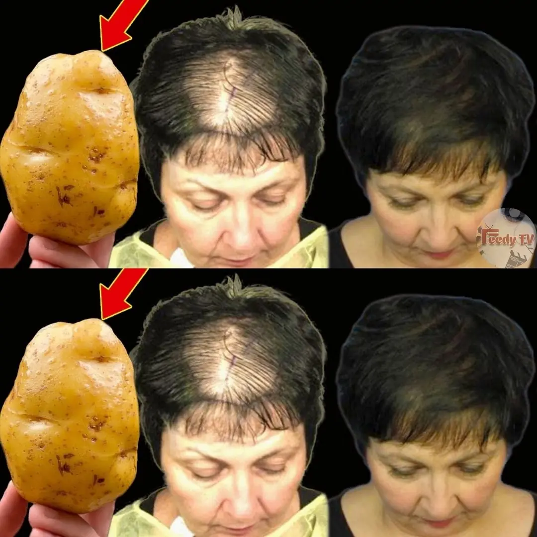 Potato Juice Is The Rising Star In Hair Growth Natural Remedies