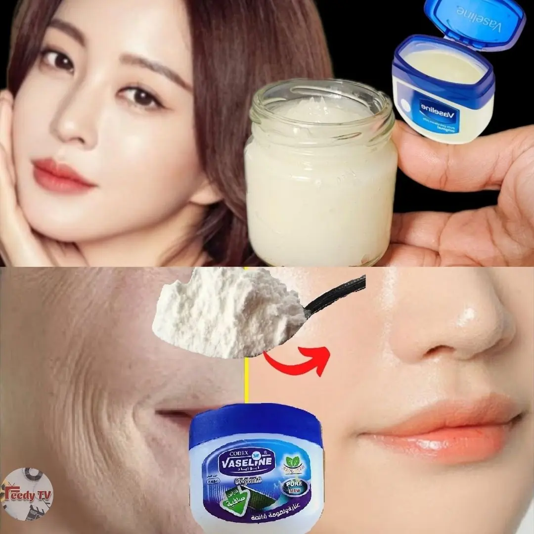 Baking Soda And Vaseline Combo Is The Ultimate Hand Care Secret