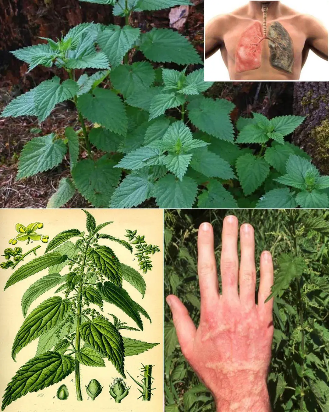 7 Nettle benefits and uses