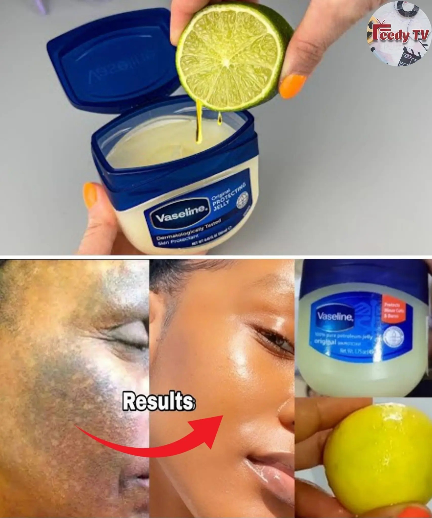 Vaseline and Lemon is the Timeless Duo For Healthy Skin
