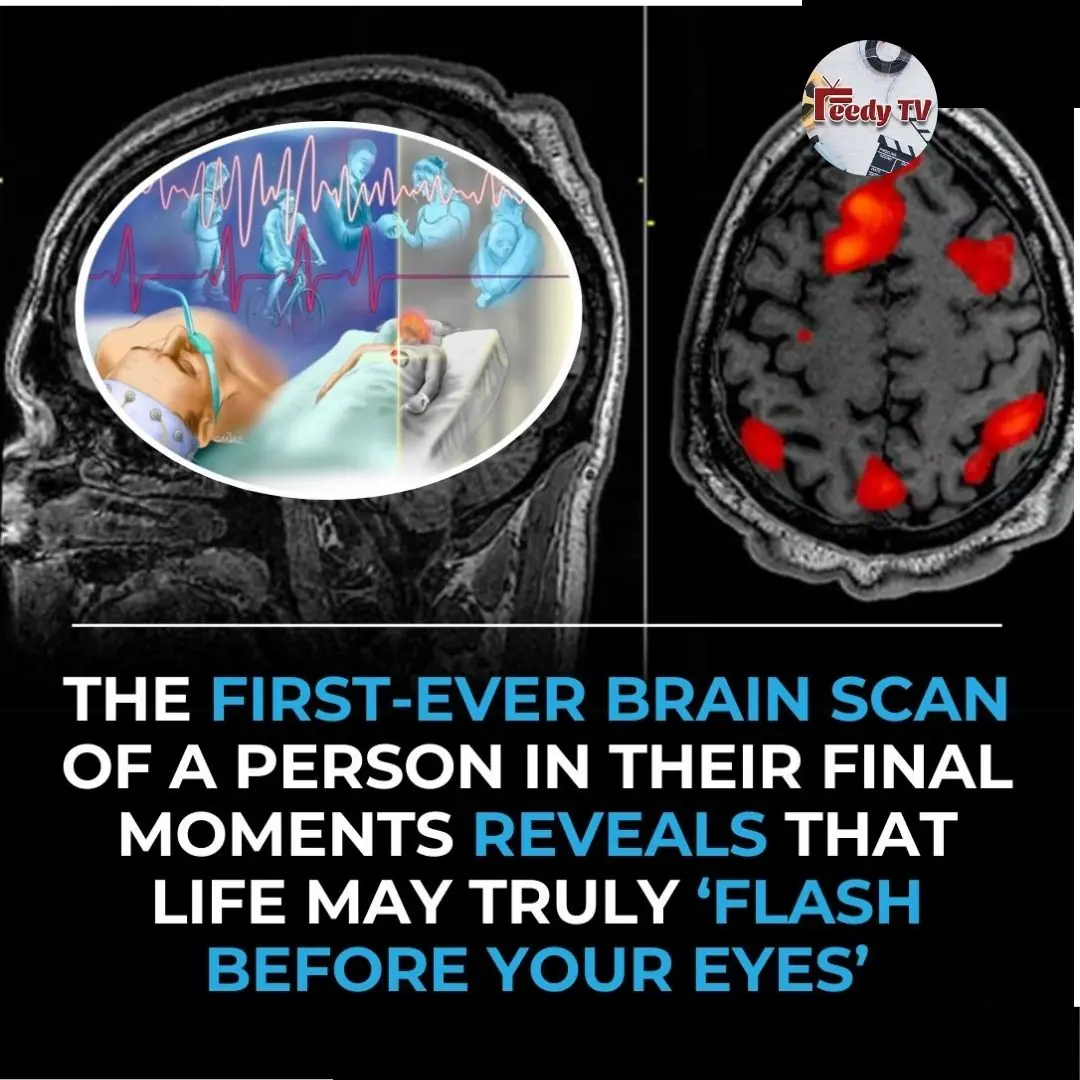 A replay of life: What happens in our brain when we die?