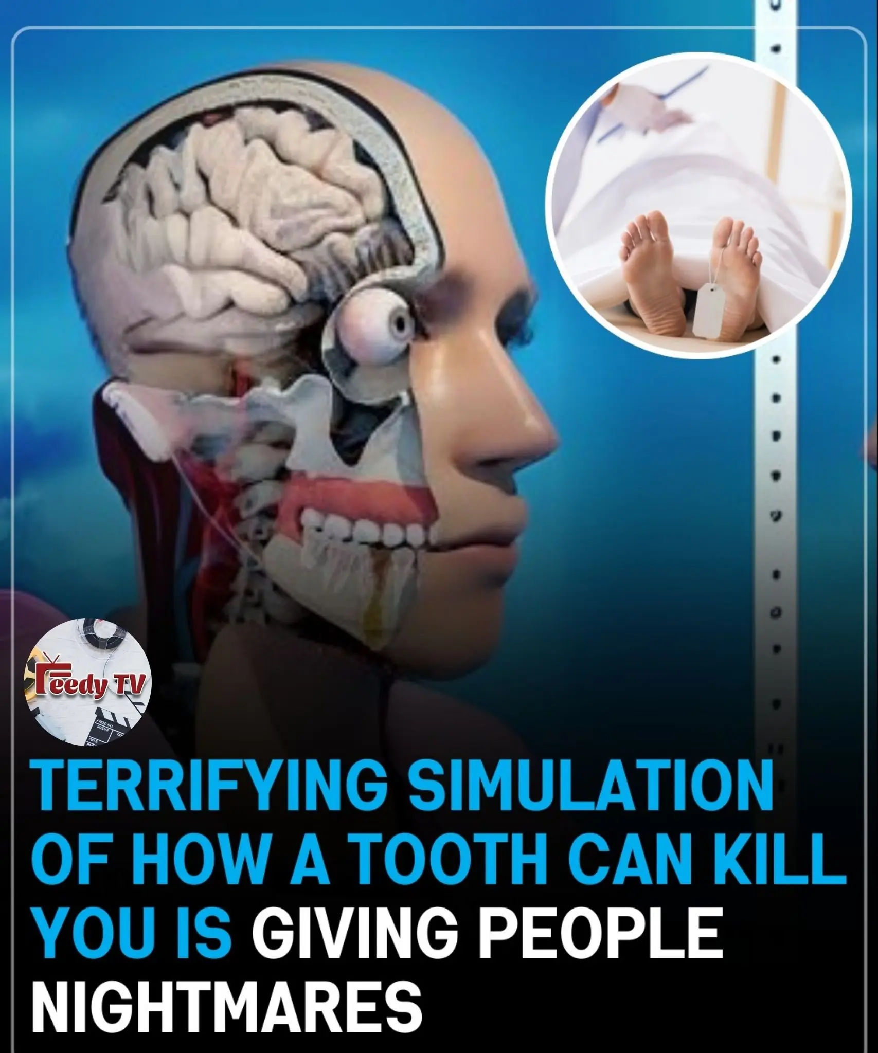 Terrifying Simulation of How a Tooth Can Kill You Is Giving People ...