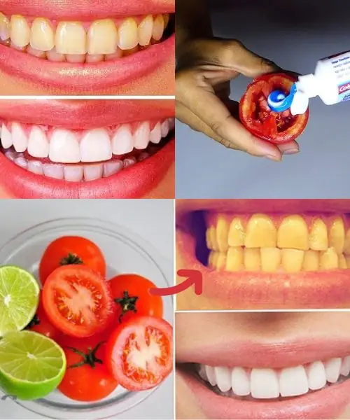 Get Sparkling Teeth with Tomato and Other Essential Ingredients: A ...