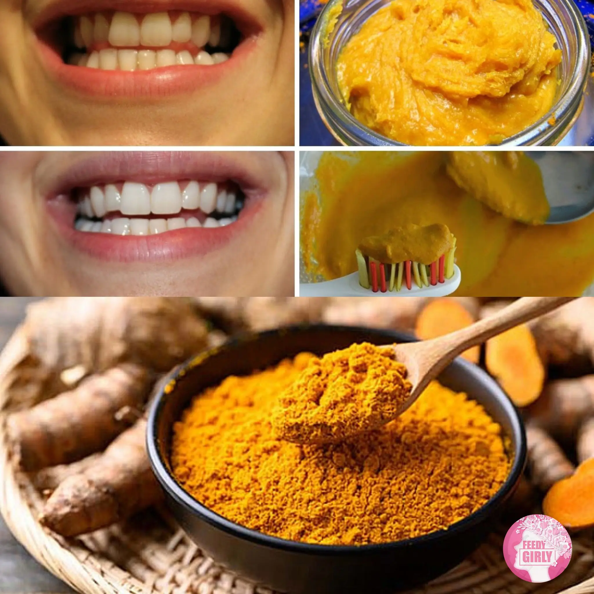 Whiten Teeth With Carrot Ends Brings Surprising Benefits You’ll Love