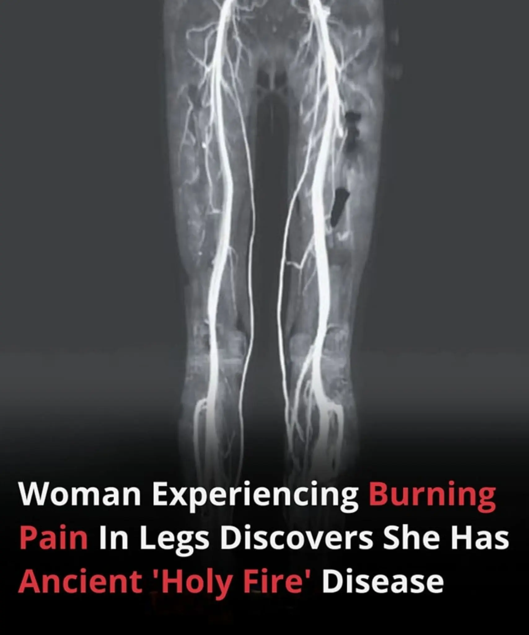 Woman Experiences Intense Leg Pain, Discovers She Has a Rare Ancient ...