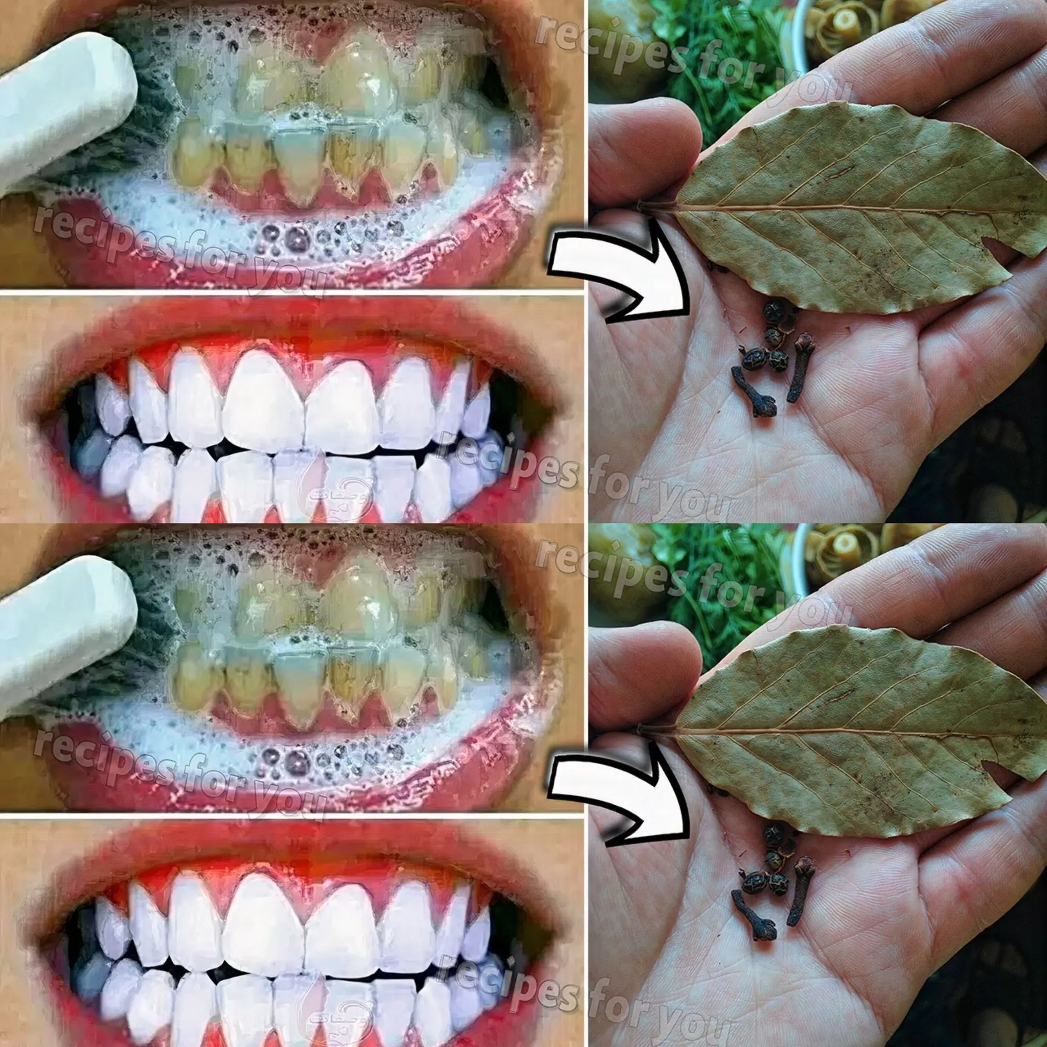 How Brightening Teeth with Bay Leaves Can Say Goodbye to Your Yellow Teeth