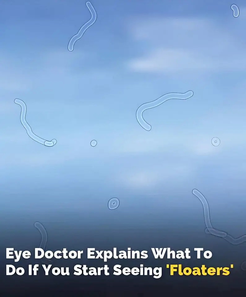 Understanding Eye Floaters: Causes and When to Seek Help