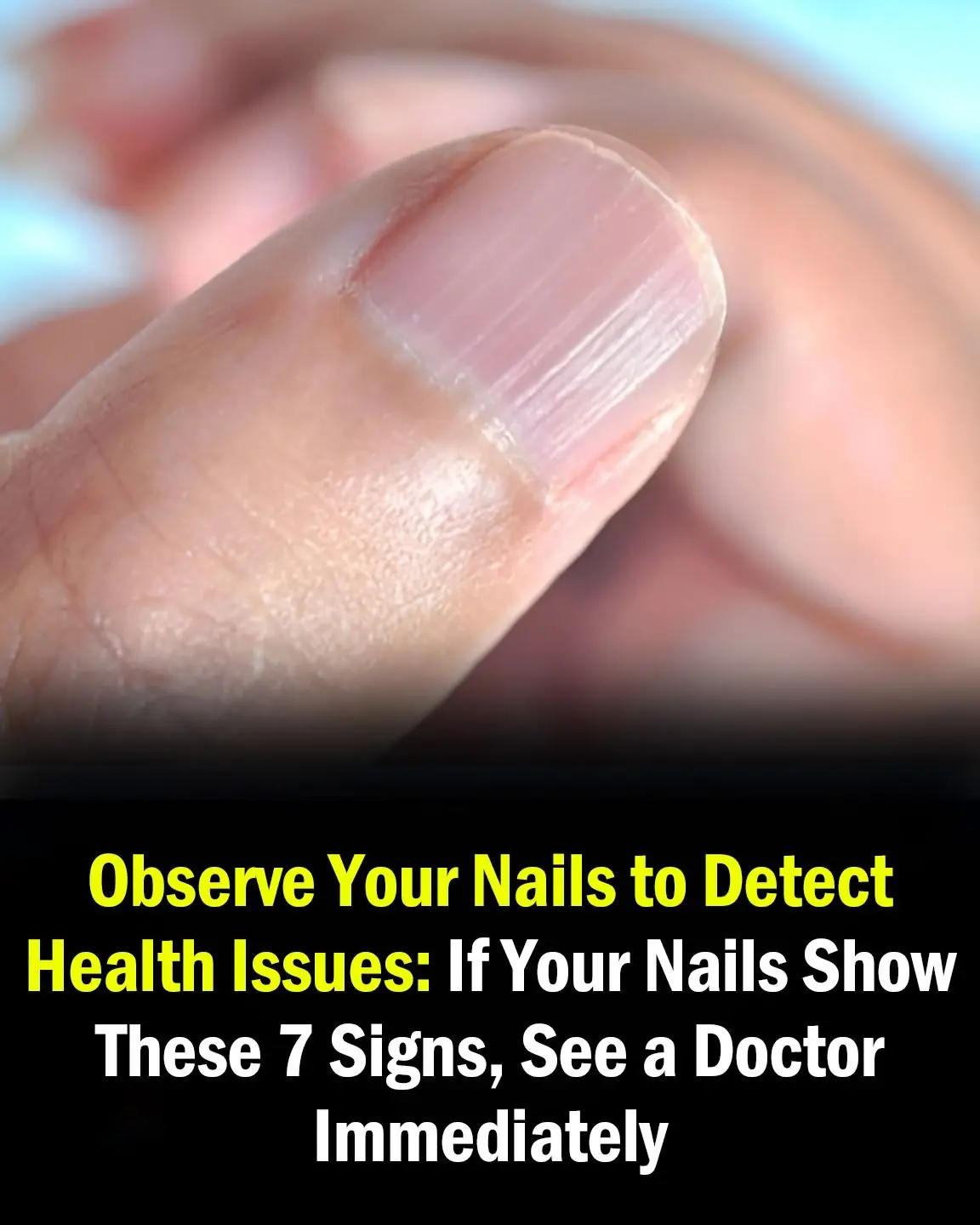 Doctor Reveals 7 Health Conditions You Can Spot By Just Checking Your Nails