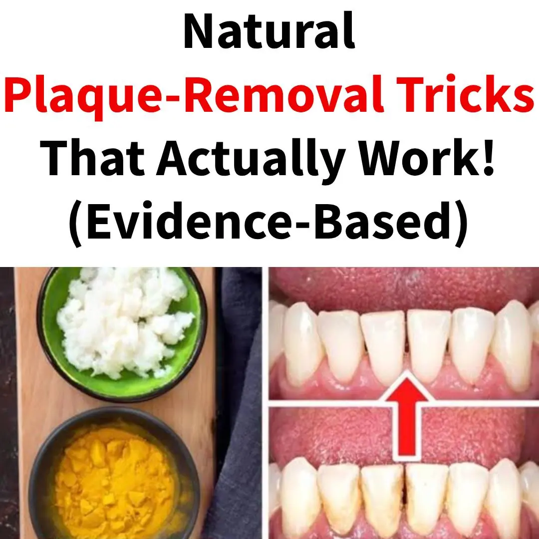 How to Remove Dental Plaque Naturally (Evidence Based)