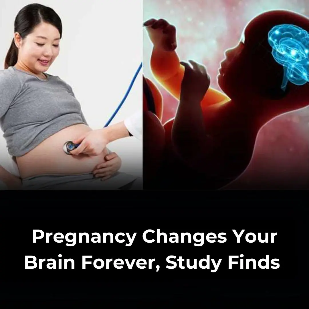 Pregnancy Changes Your Brain Forever, Study Finds