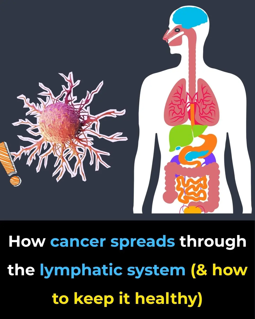 How Cancer Spreads Through The Lymphatic System (And How To Keep It ...