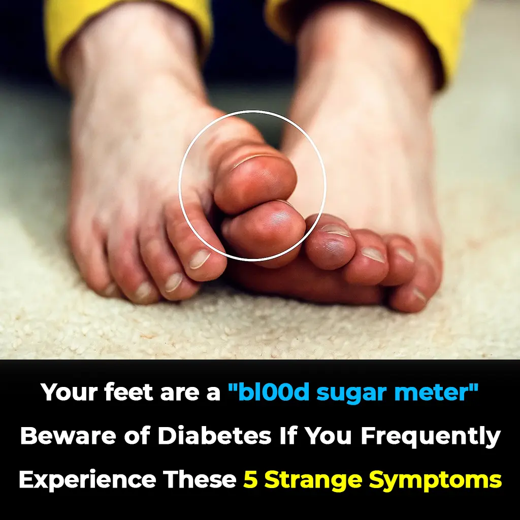 10 Sh0cking Diabetes Symptoms That First Appear in Your Feet – Don’t ...