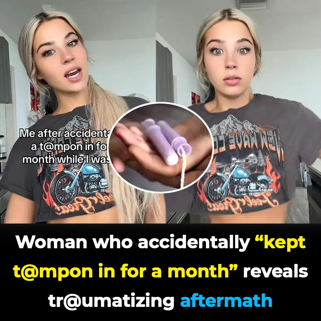 Woman who accidentally "kept t@mpon in for a month" reveals tr ...