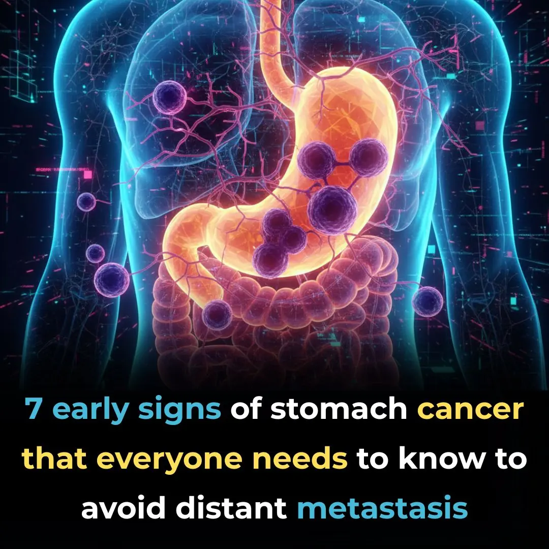 7 Early Signs of Stomach Cancer Everyone Should Know Before It Spreads
