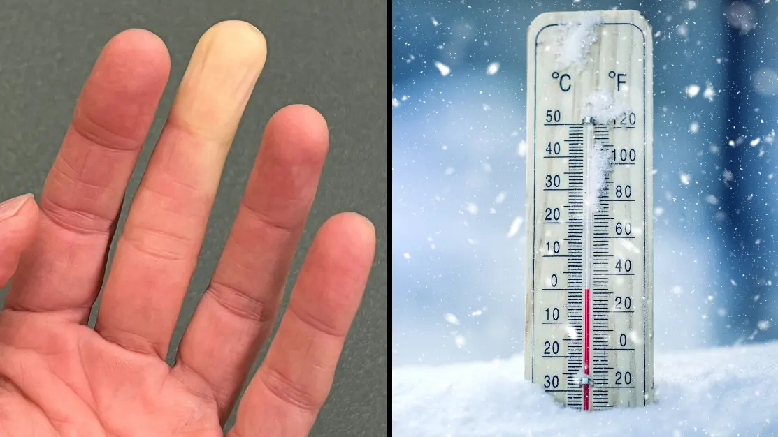Why Your Fingers Turn a Different Color in Cold Winter Months