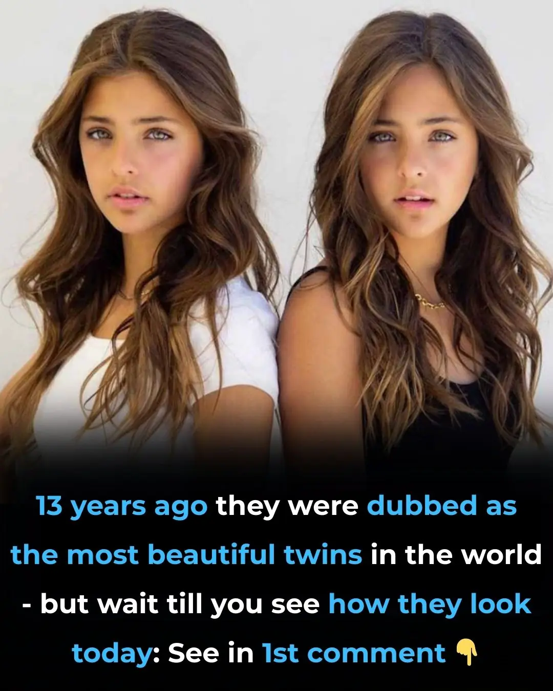 Clements Twins, The “Most Beautiful Twins” 10 Years Later