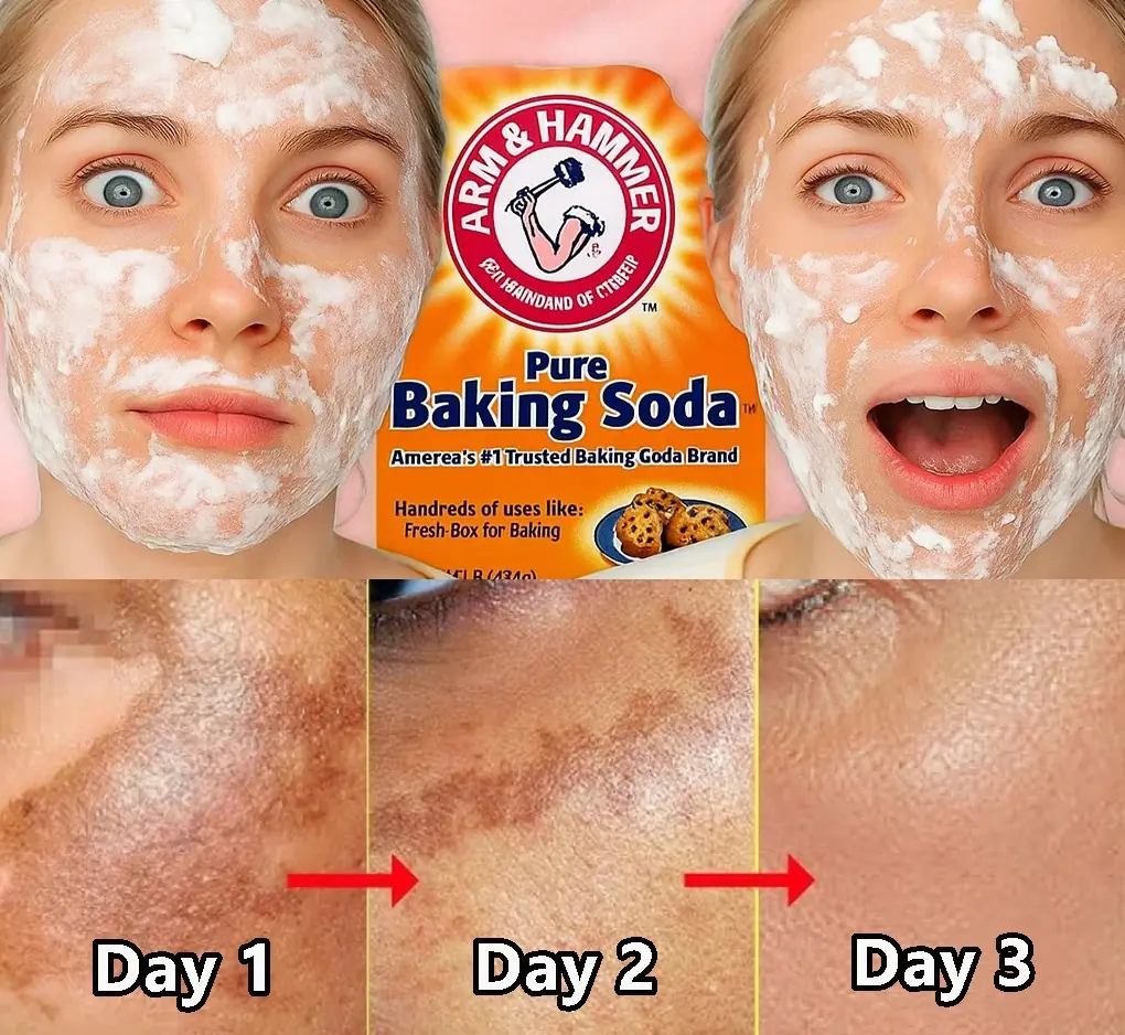 Homemade Baking Soda Cream: A Natural Secret to Fade Wrinkles, Dark ...