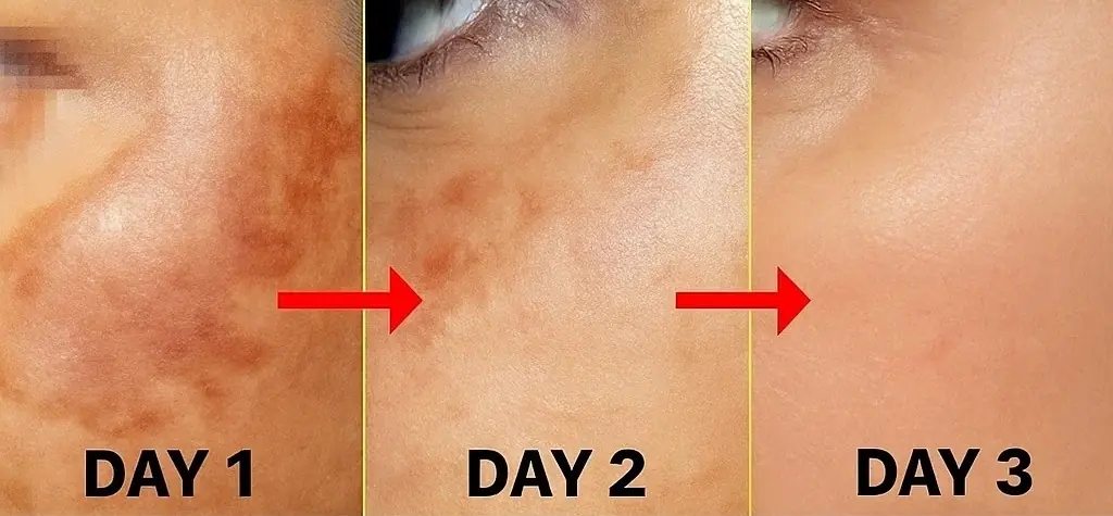 Homemade Baking Soda Cream: A Natural Secret to Fade Wrinkles, Dark ...