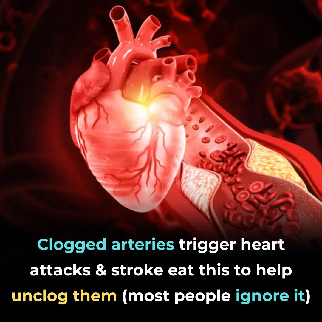 The Best Foods to Cleanse and Prevent Clogged Arteries