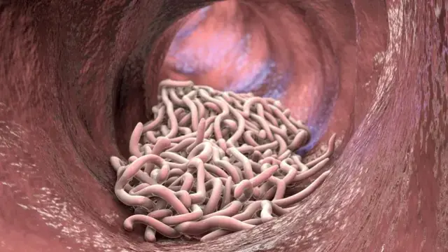 How to Get Rid of Intestinal Parasites