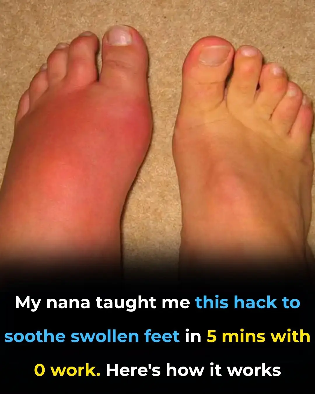 My nana taught me this hack to soothe swollen feet in 5 mins with 0 ...