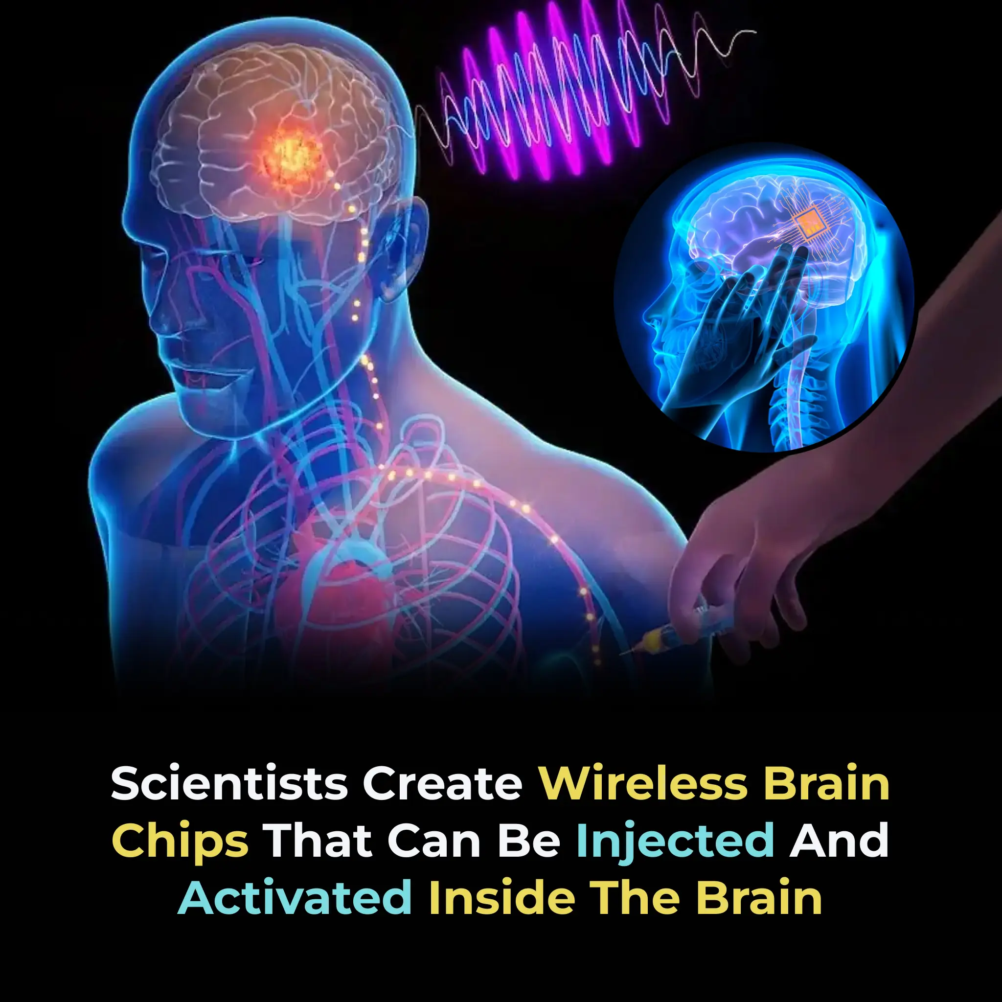 MIT’s Circulatronics: A Non-Invasive Brain-Tech Breakthrough