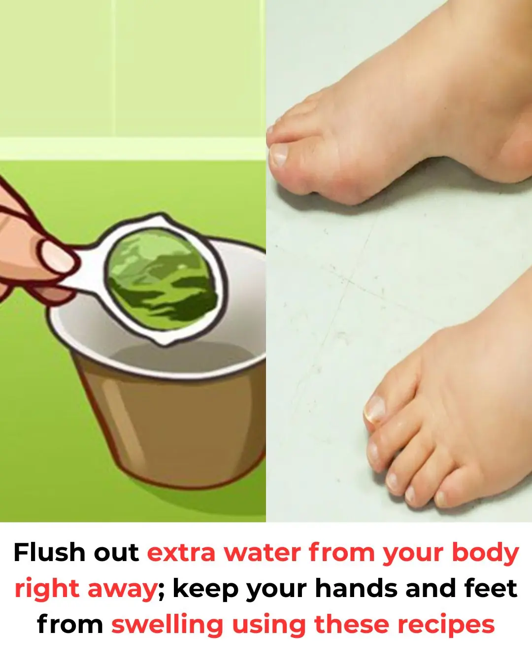 Say Goodbye to Swelling …Natural Ways to Beat Water Retention Fast