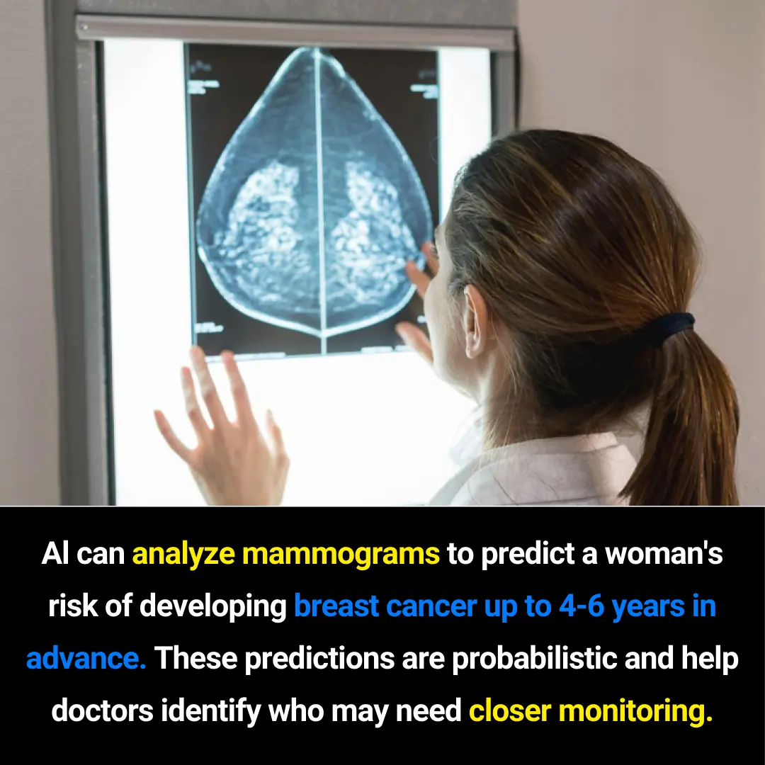 How AI Is Transforming Early Breast Cancer Detection: Predicting Risk ...