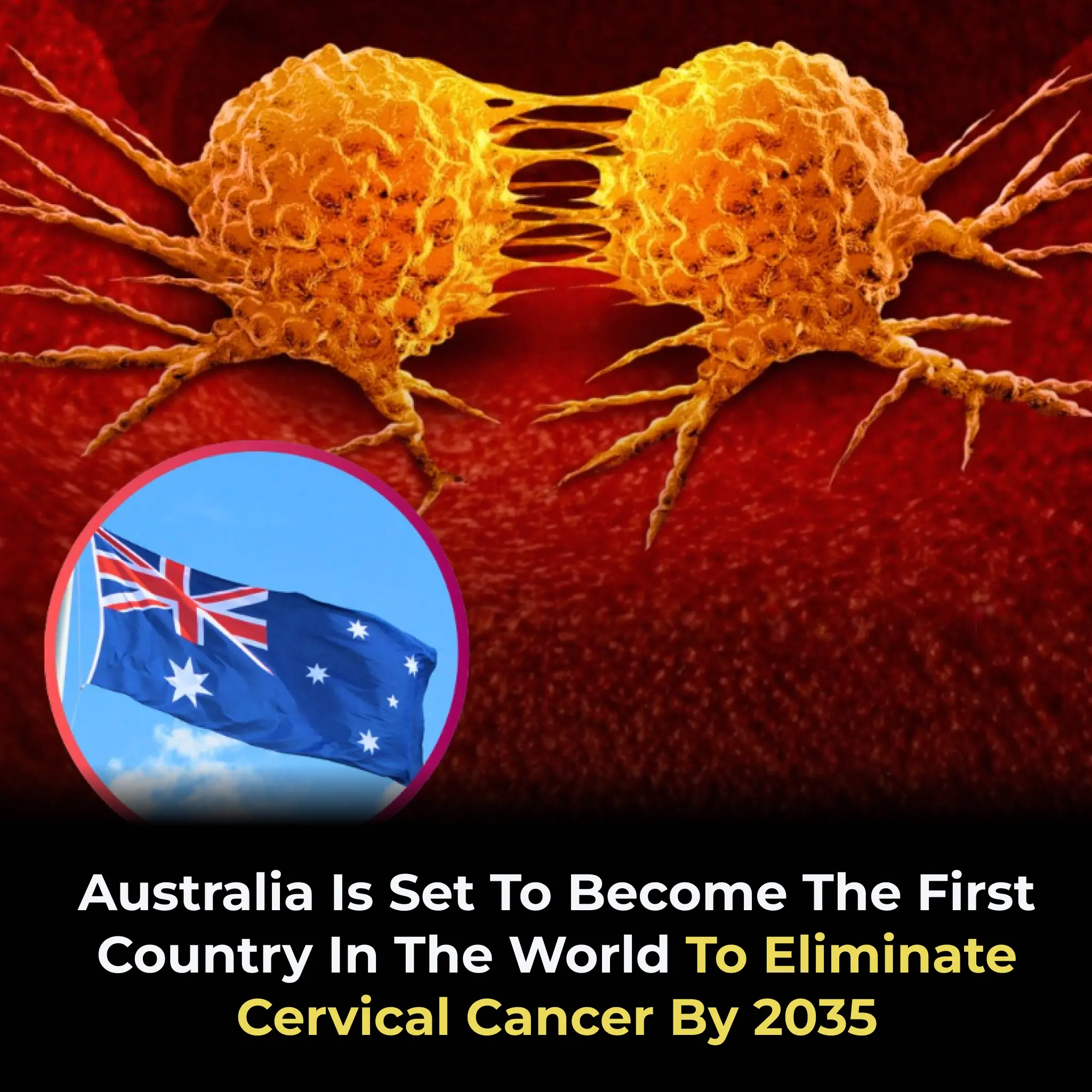 Australia Is Set to Become the First Country in the World to Eliminate ...