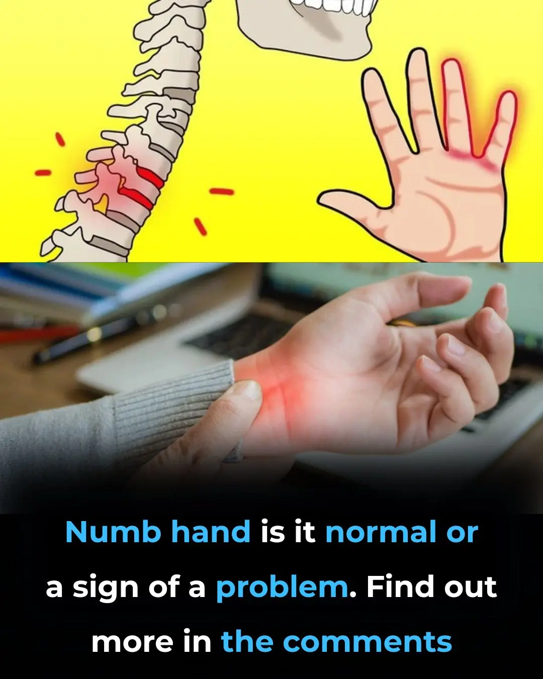 Numb Hand Is It Normal